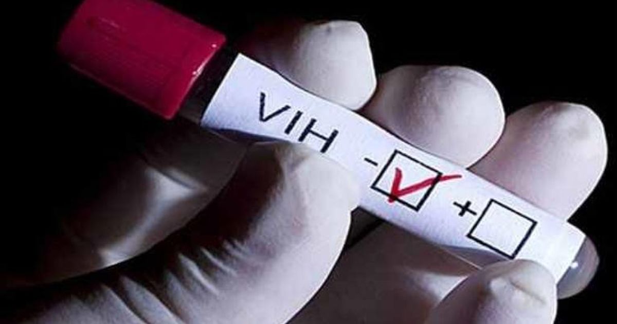 Se cumplen 40 años del descubrimiento del virus del sida